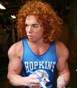 Before and After Photos of Carrot Top | Plastic Surgery?